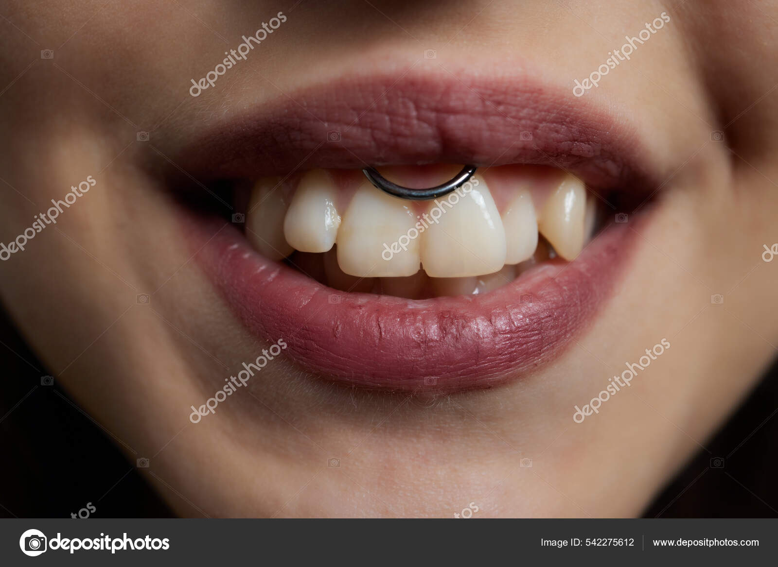 Frenulum Lip