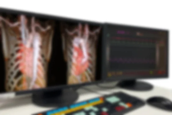 Gaussian blur CT scan angiography 3D rendering image, X-ray medical ...