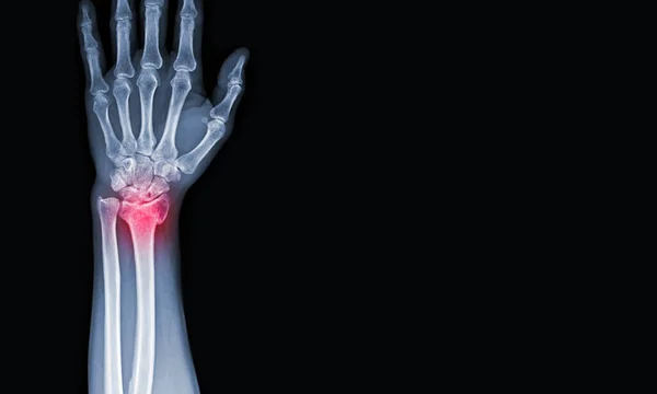 X ray injuries Stock Photos, Royalty Free X ray injuries Images ...