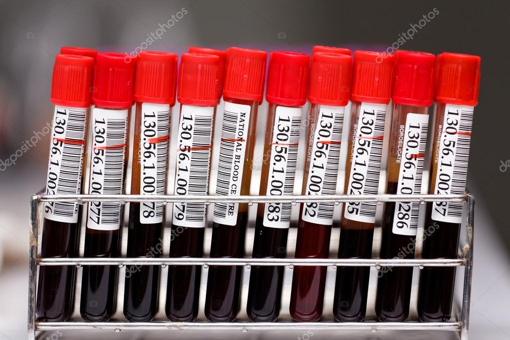 Sample blood tubes in laboratory Stock Photo by ©Surabky 19665195