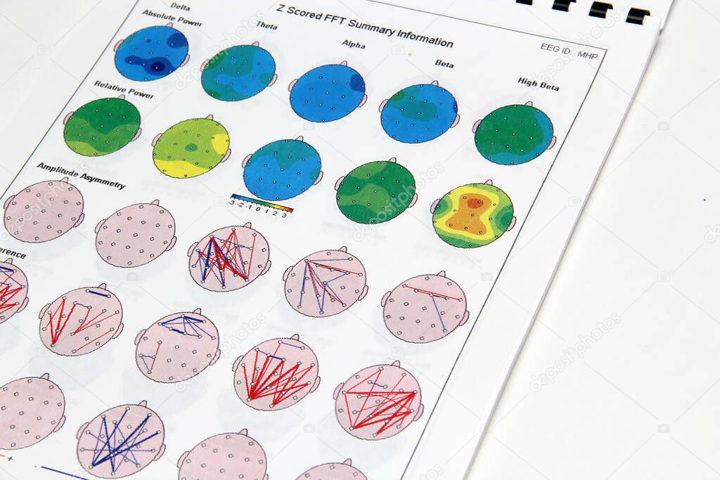 Brain mapping done by a neurologist doctor with neuroscience technique ...