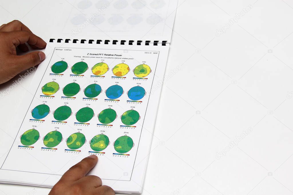 Brain mapping done by a neurologist doctor with neuroscience technique ...