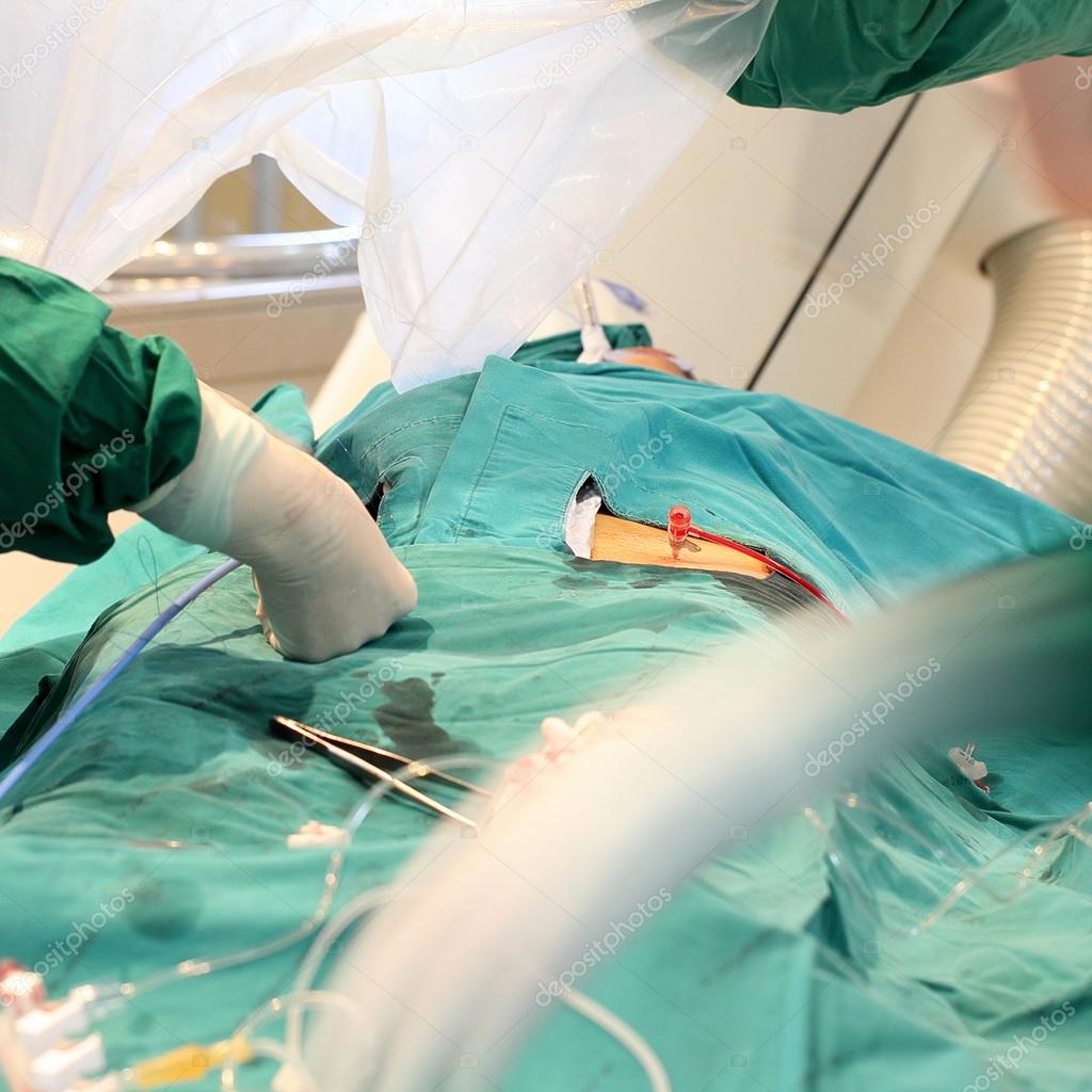 Cardiac surgery operation team Stock Photo by ©hin255 41845873