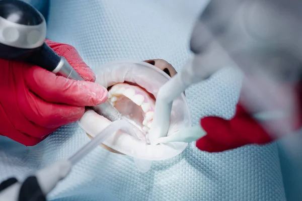 Close up of dentists hands in the process of brushing female patient's ...