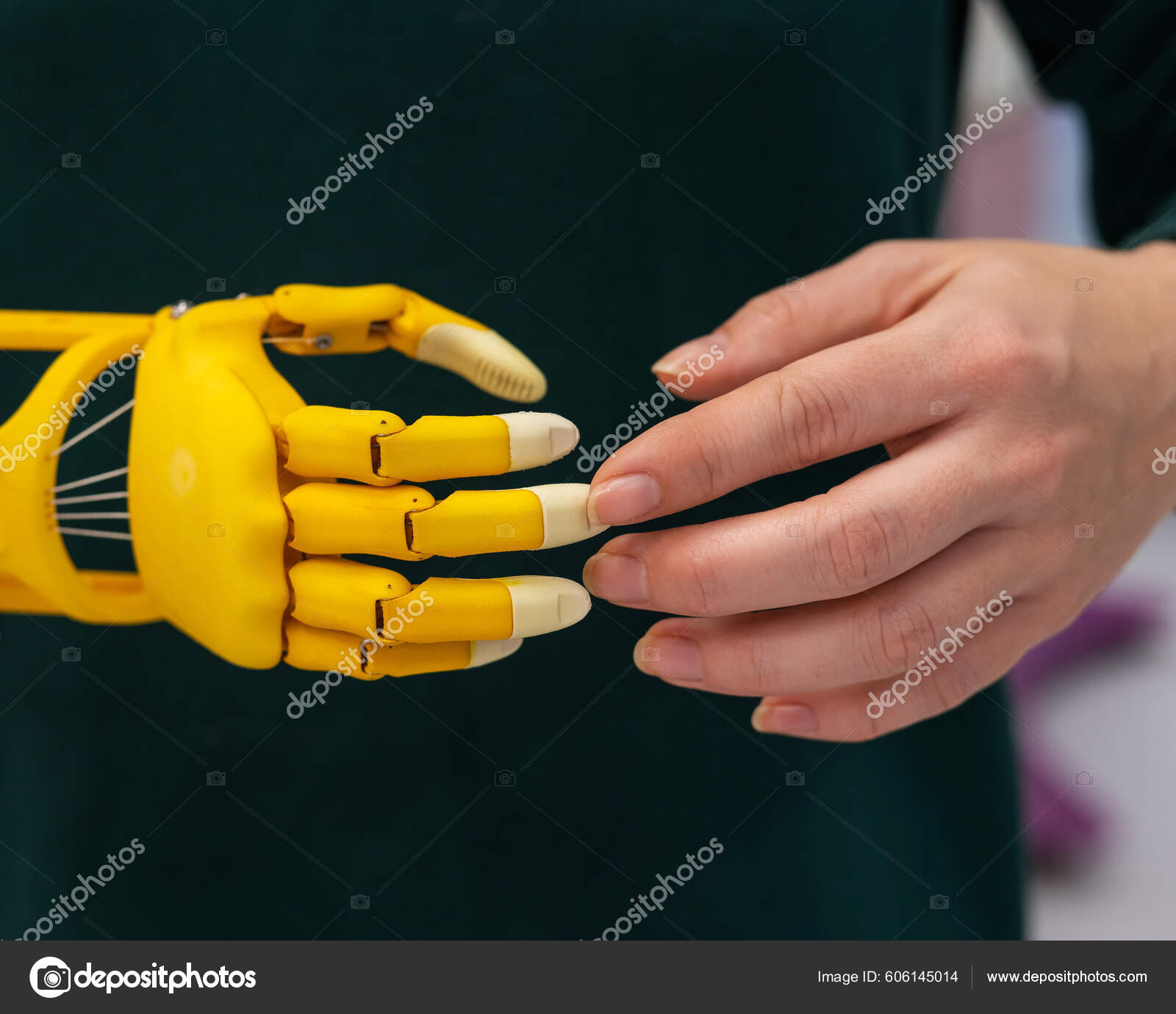 Woman Demonstrates Plastic Childrens Prosthetic Hand Printed Printer ...