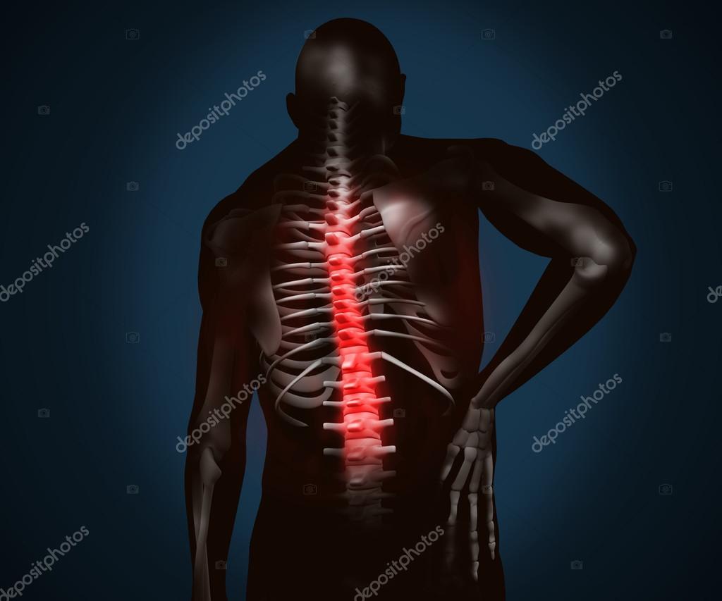 Black digital figure with back pain Stock Photo by ©Wavebreakmedia 24109369