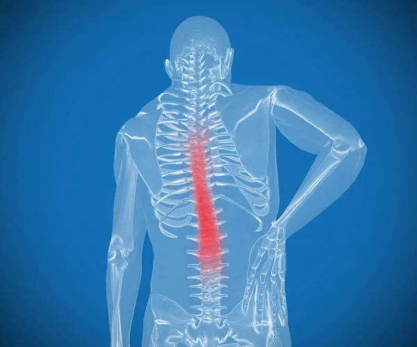 Back pain skeleton Stock Photos, Royalty Free Back pain skeleton Images ...