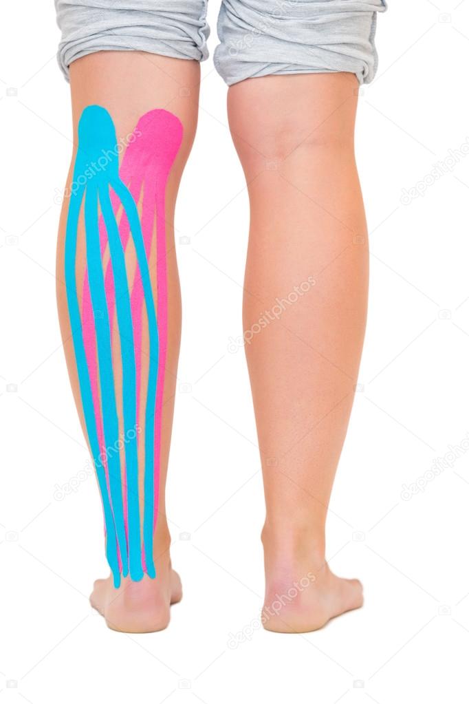Female patients leg with applied pink and blue kinesio tape Stock Photo ...