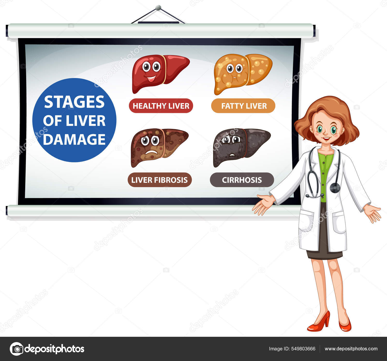 Diagram Showing Stages Liver Damage Illustration Stock Vector by ... Diagram Showing Stages Liver Damage Illustration Stock Vector by ...