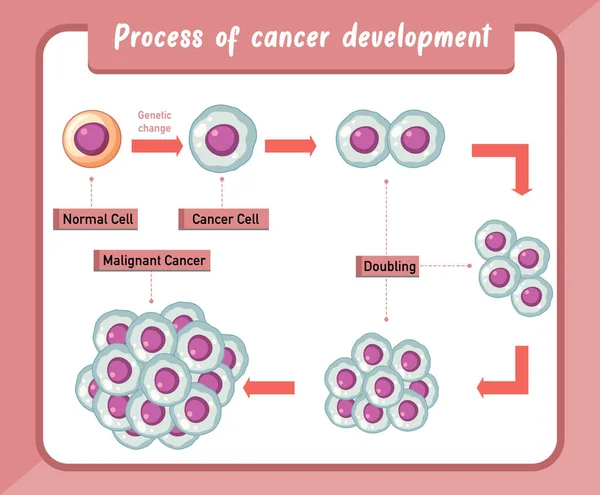 Diagram Showing Cancer Development Process Illustration Stock Vector by ...