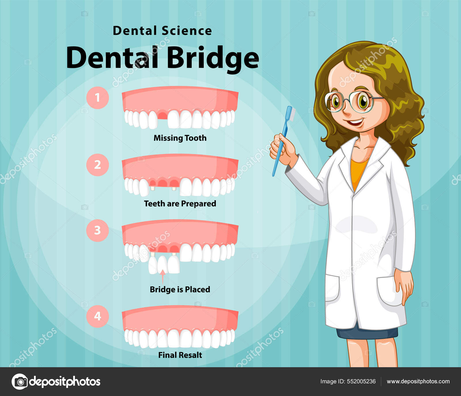 Infographic Human Dental Bridge Illustration Stock Vector Image by ...