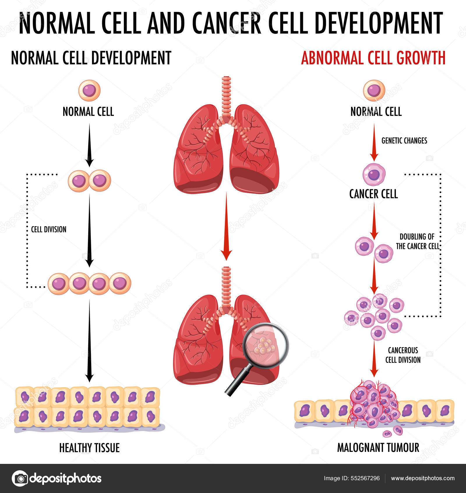 Diagram Showing Normal Cancer Cells Human Illustration Stock Vector ...