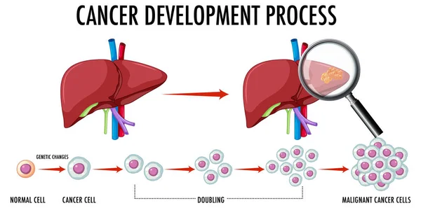 Diagrama Que Muestra Ilustración Del Proceso Desarrollo Del Cáncer ...