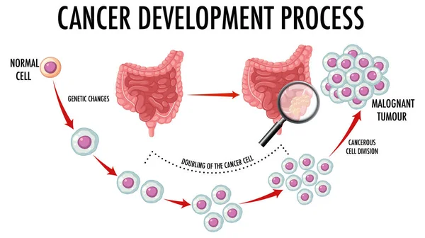 Illustrated Infographic Depicting Development Processing Cancer Cells ...
