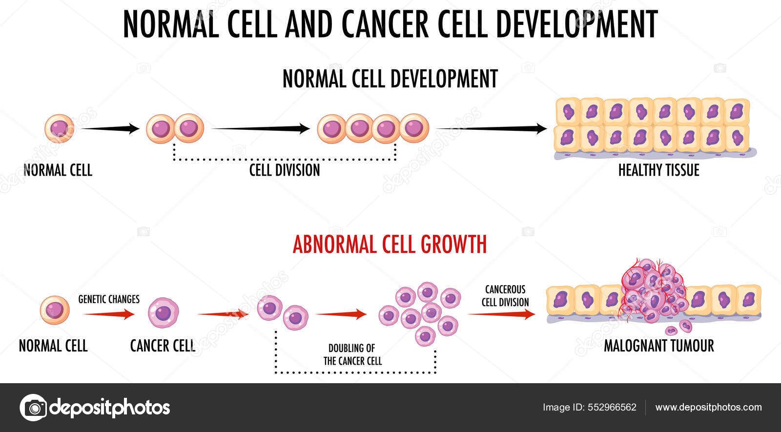 Diagram Showing Normal Cancer Cells Illustration Stock Vector by ...
