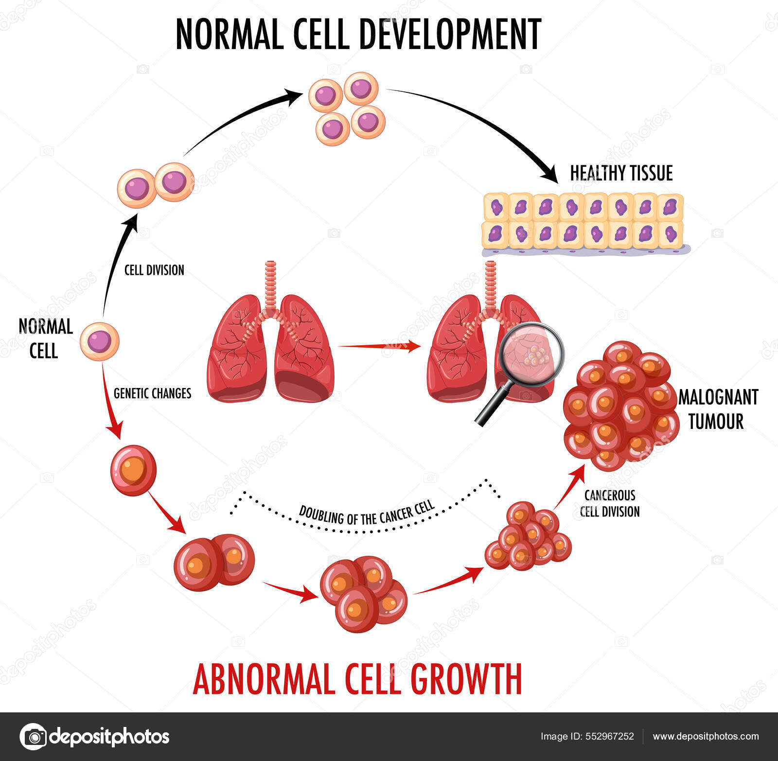 Diagram Showing Cancer Development Process Illustration Stock Vector ...