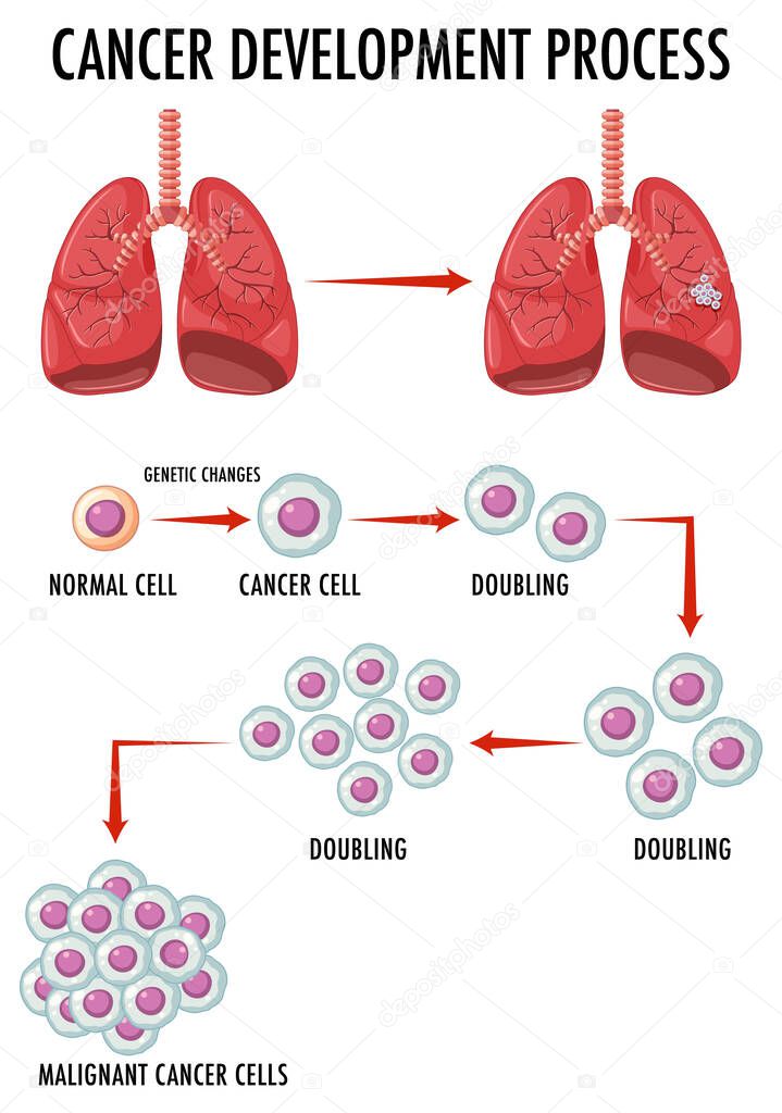Diagrama Que Muestra Ilustración Del Proceso Desarrollo Del Cáncer ...
