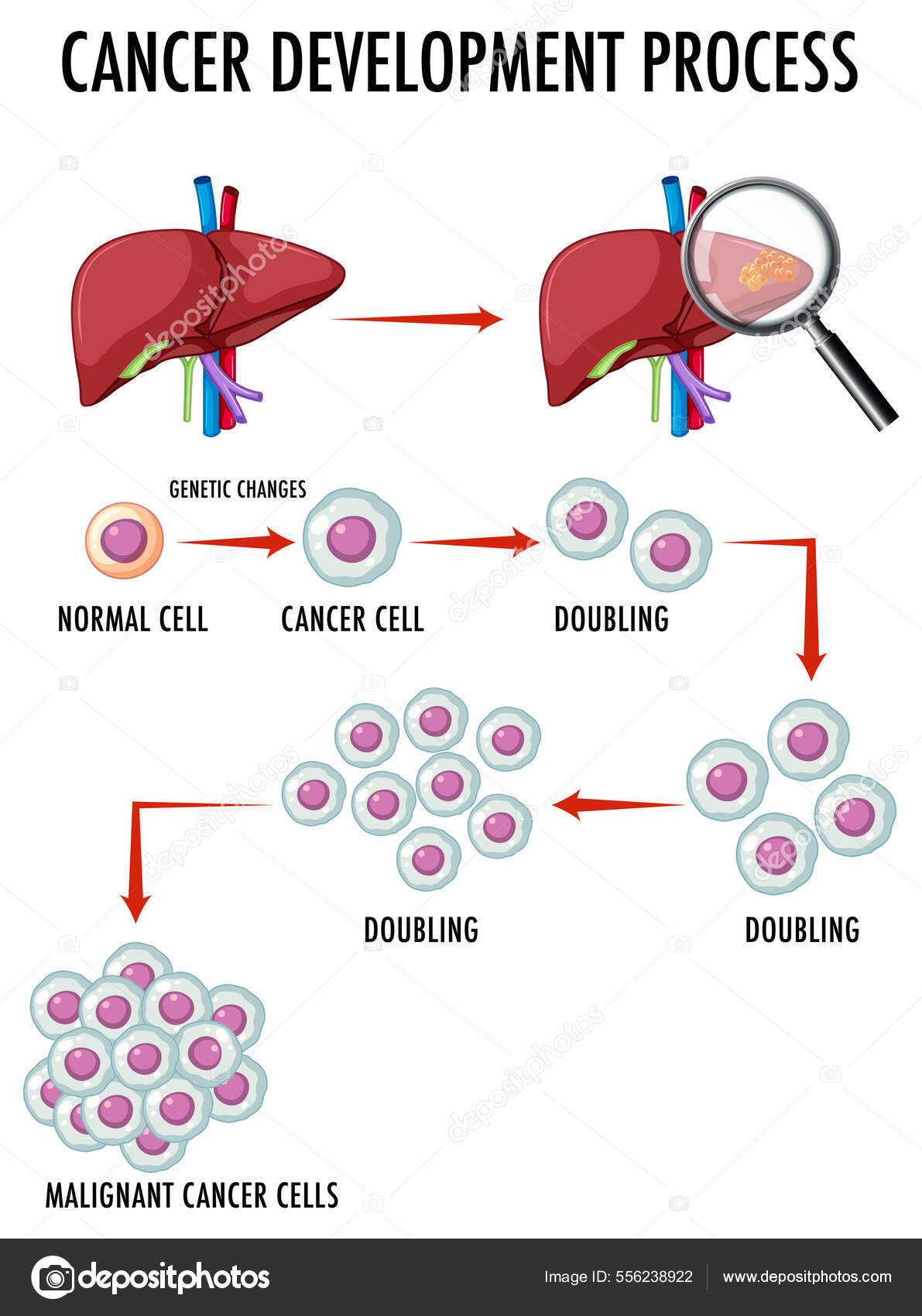 Diagram Showing Cancer Development Process Illustration Stock ...