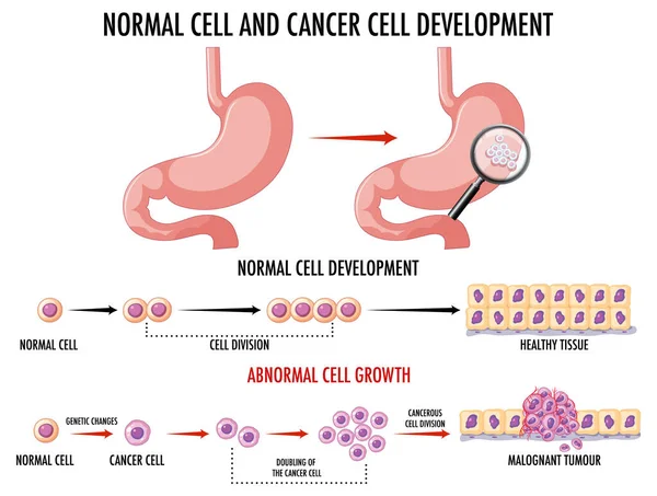 Diagram Showing Normal Cell Development Illustration Stock Vector by ...
