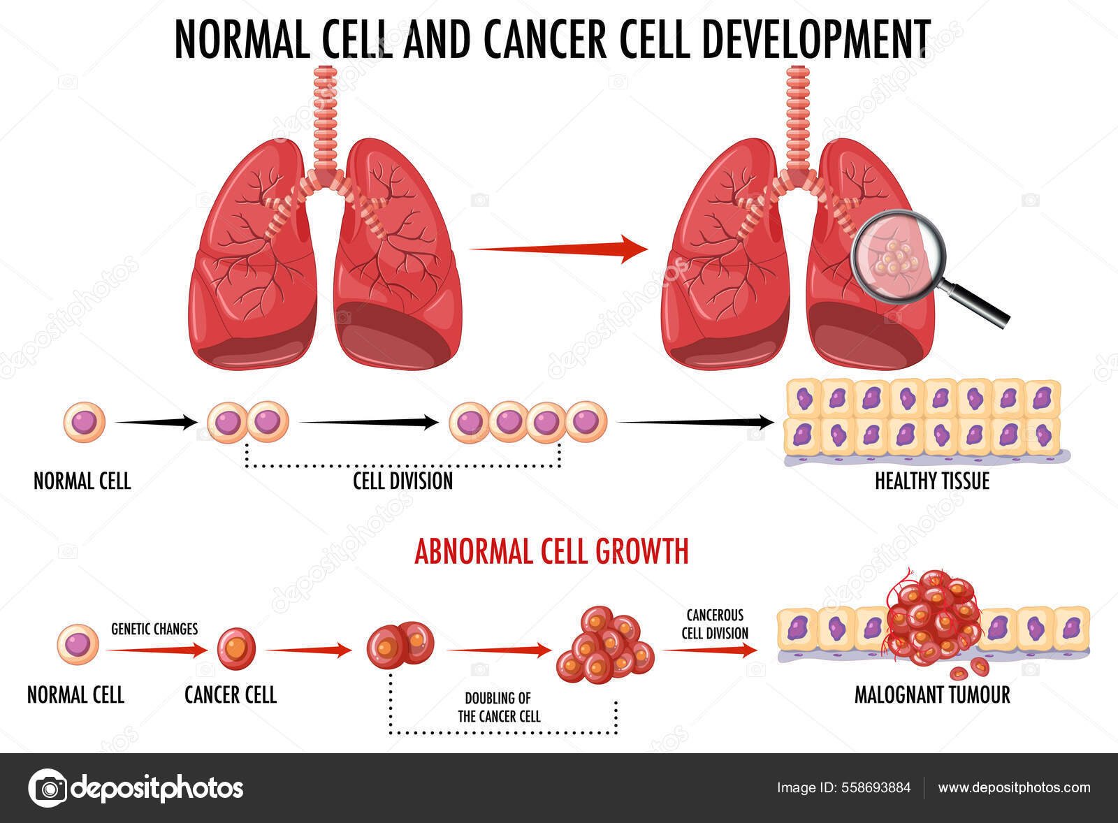 Diagrama Mostrando Ilustração Normal Células Cancerígenas imagem ...