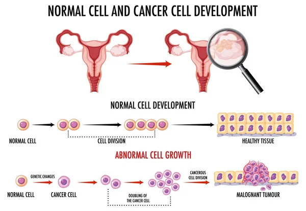 Diagram Showing Normal Cell Development Illustration Stock Vector by ...