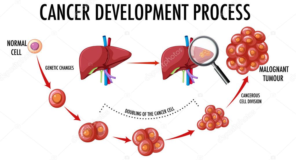 Diagrama Que Muestra Ilustración Del Proceso Desarrollo Del Cáncer ...