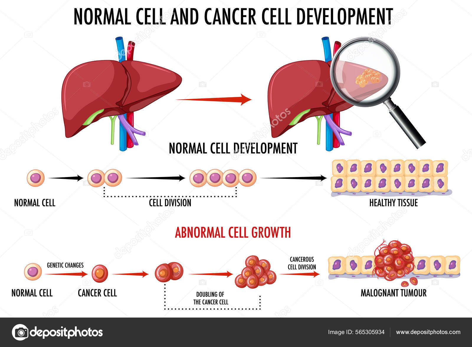 Diagram Showing Cancer Development Process Illustration Stock Vector ...