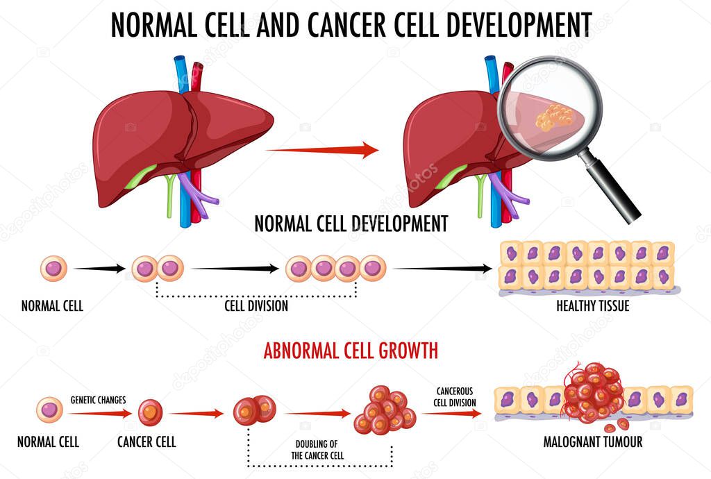 Diagrama Que Muestra Ilustración Del Proceso Desarrollo Del Cáncer ...