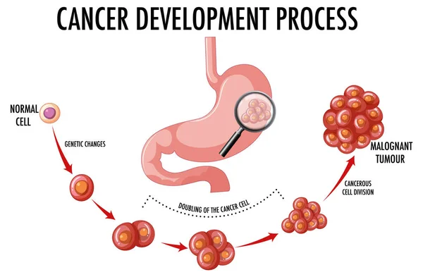 Illustrated Infographic Depicting Development Processing Cancer Cells ...