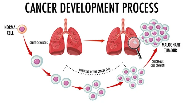 Illustrated Infographic Depicting Development Processing Cancer Cells ...