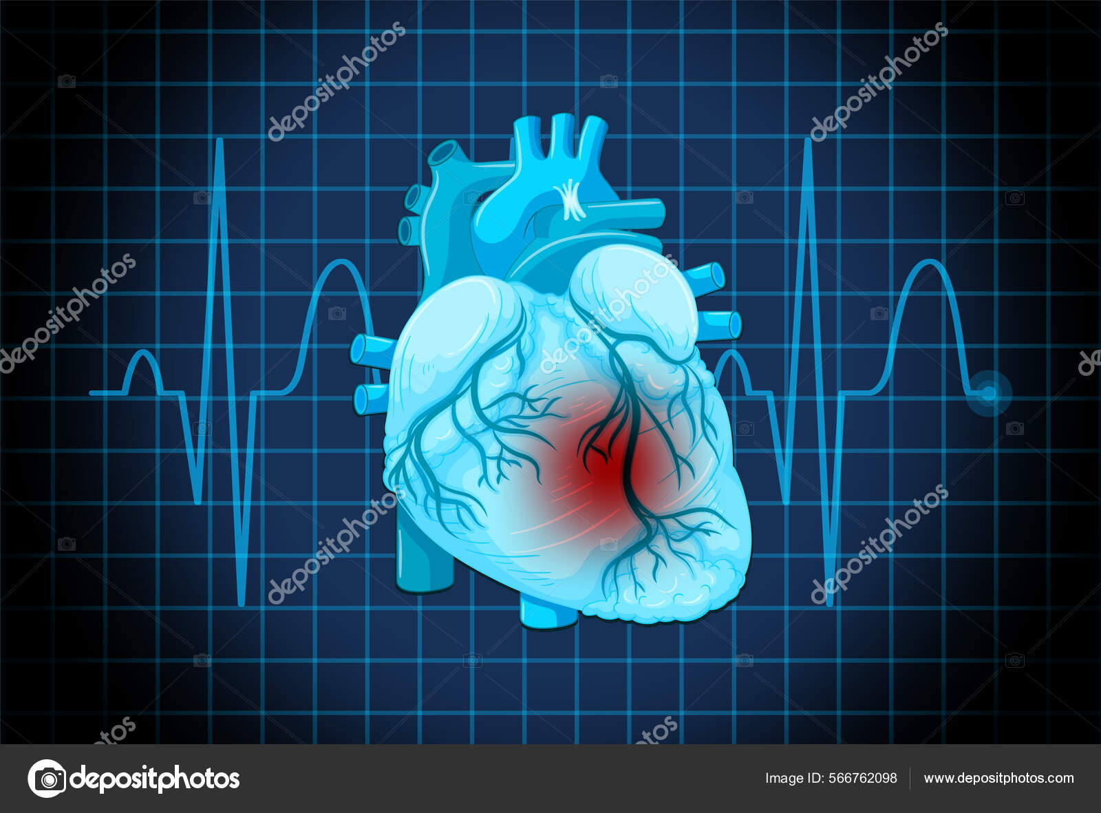 Ilustración Del Símbolo Enfermedad Cardíaca Humana Vector de stock por ...