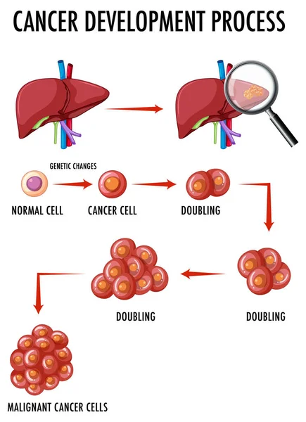 Illustrated Infographic Depicting Development Processing Cancer Cells ...
