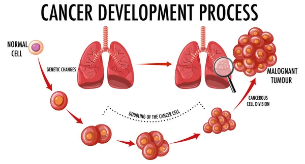 Diagram Showing Cancer Development Process Illustration Stock Vector by ...