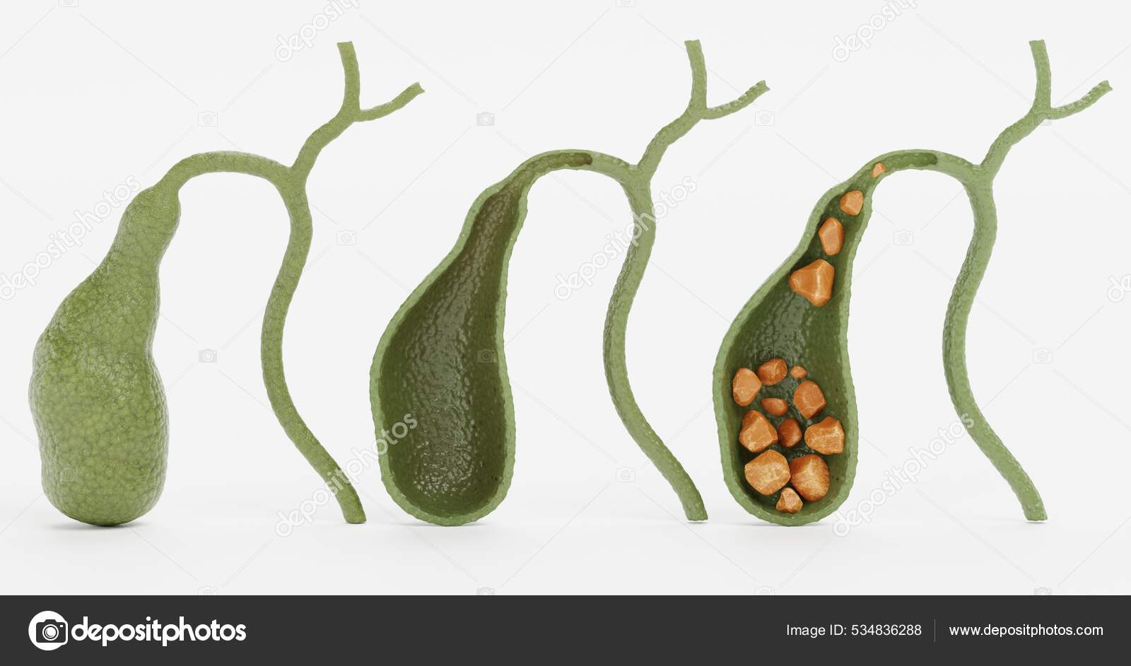 Realistic Render Gallbladder — Stock Photo © 3drenderings #534836288