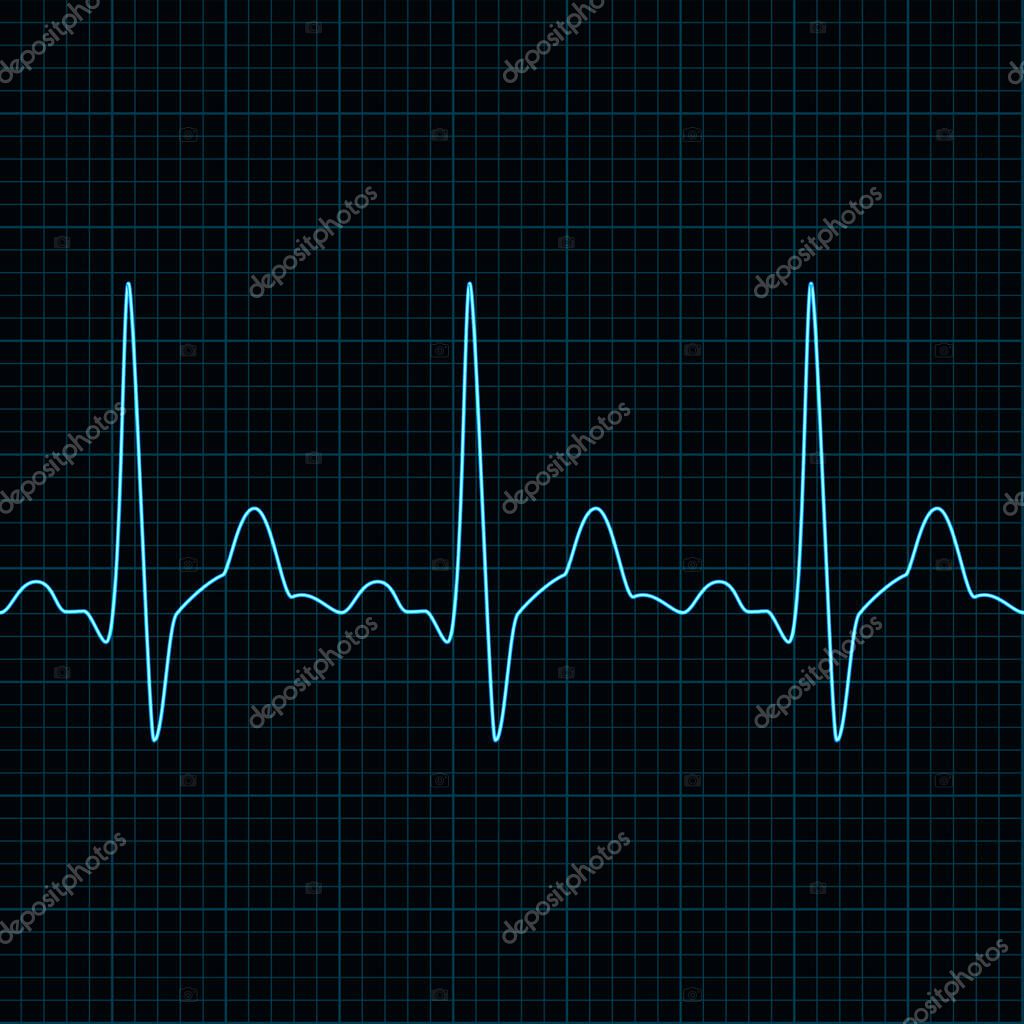 Latido del corazón ecg o ekg línea de neón sin costura sobre fondo azul ...