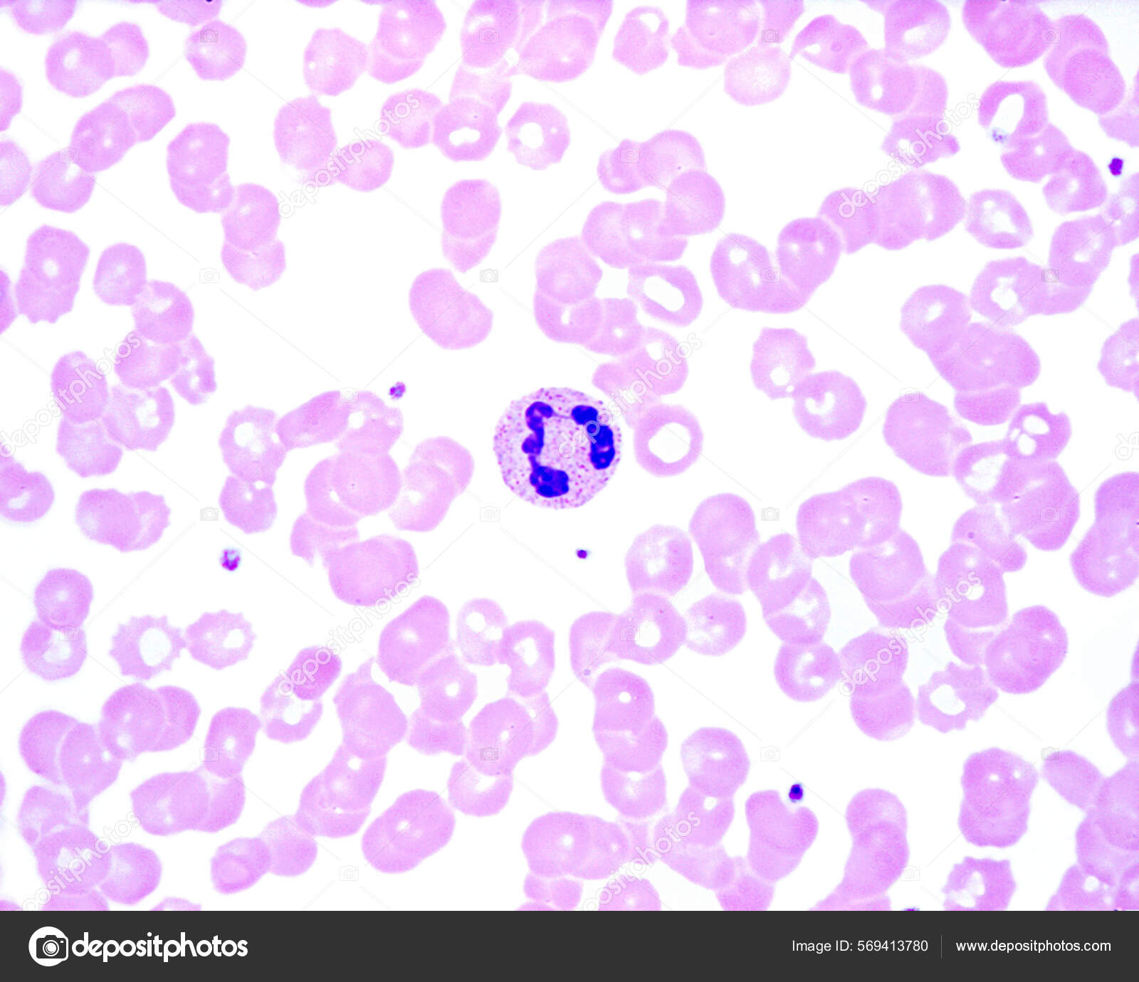 Leukocytes Histology