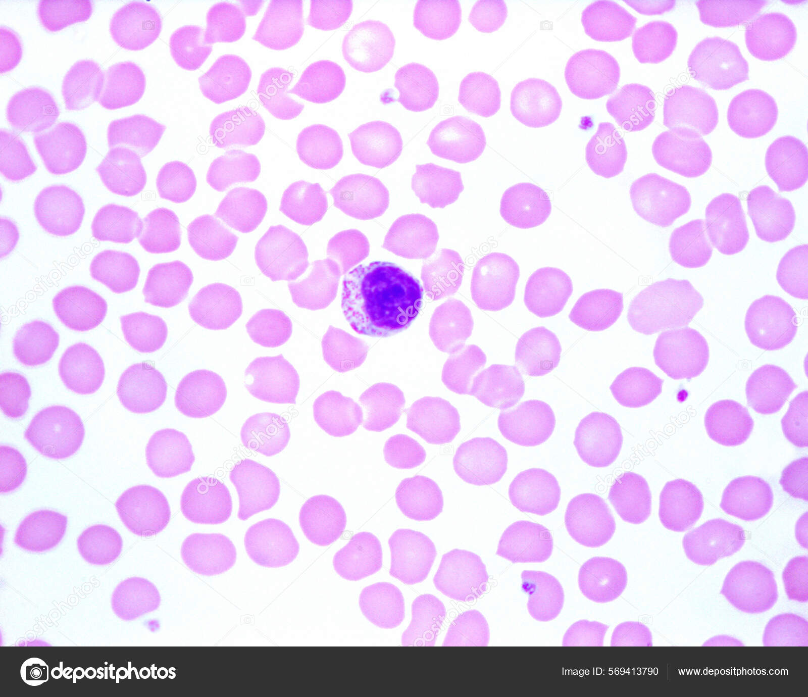 Frottis Sanguin Humain Montrant Leucocyte Monocytaire Avec Quelques ...