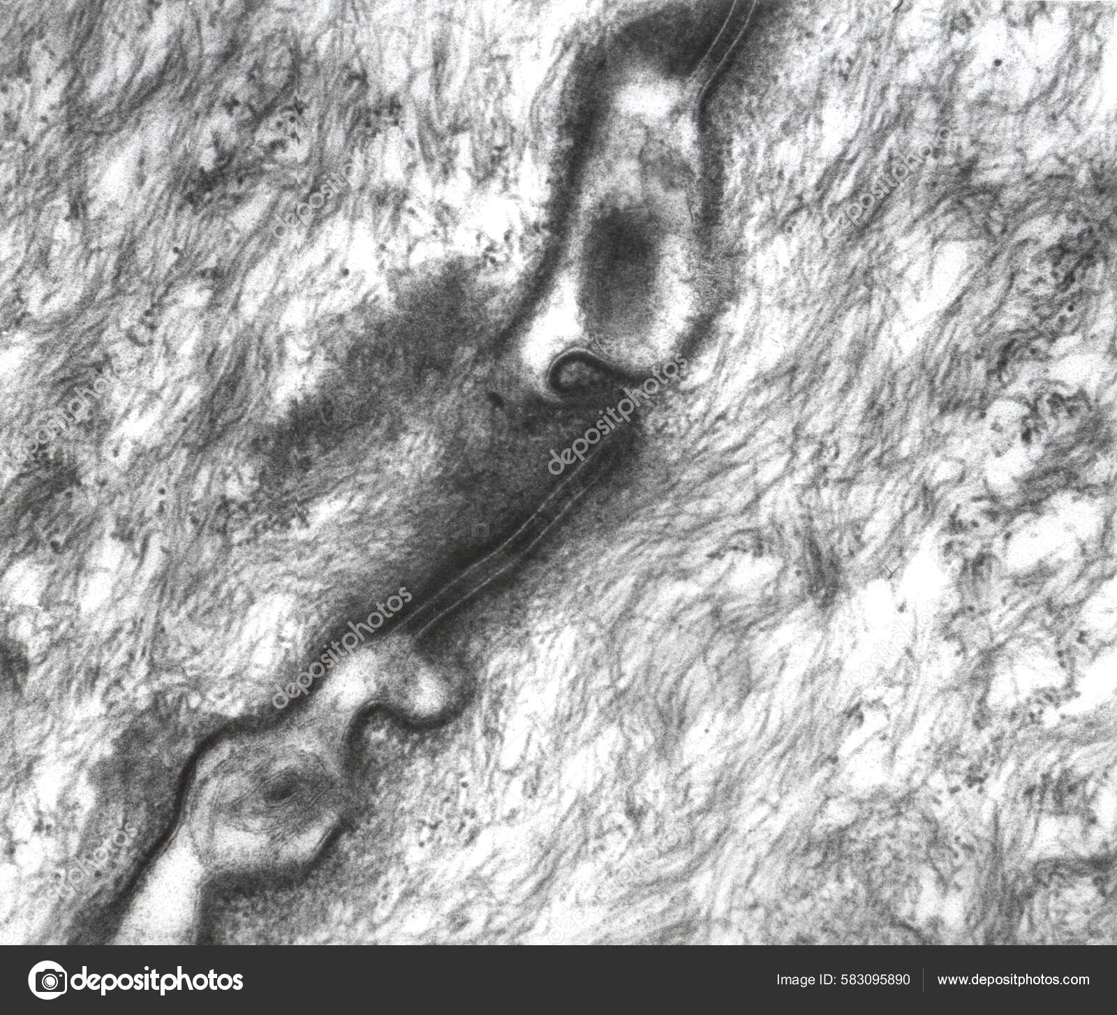 Transmission Electron Micrograph Tem Showing Desmosome Macula Adherens ...