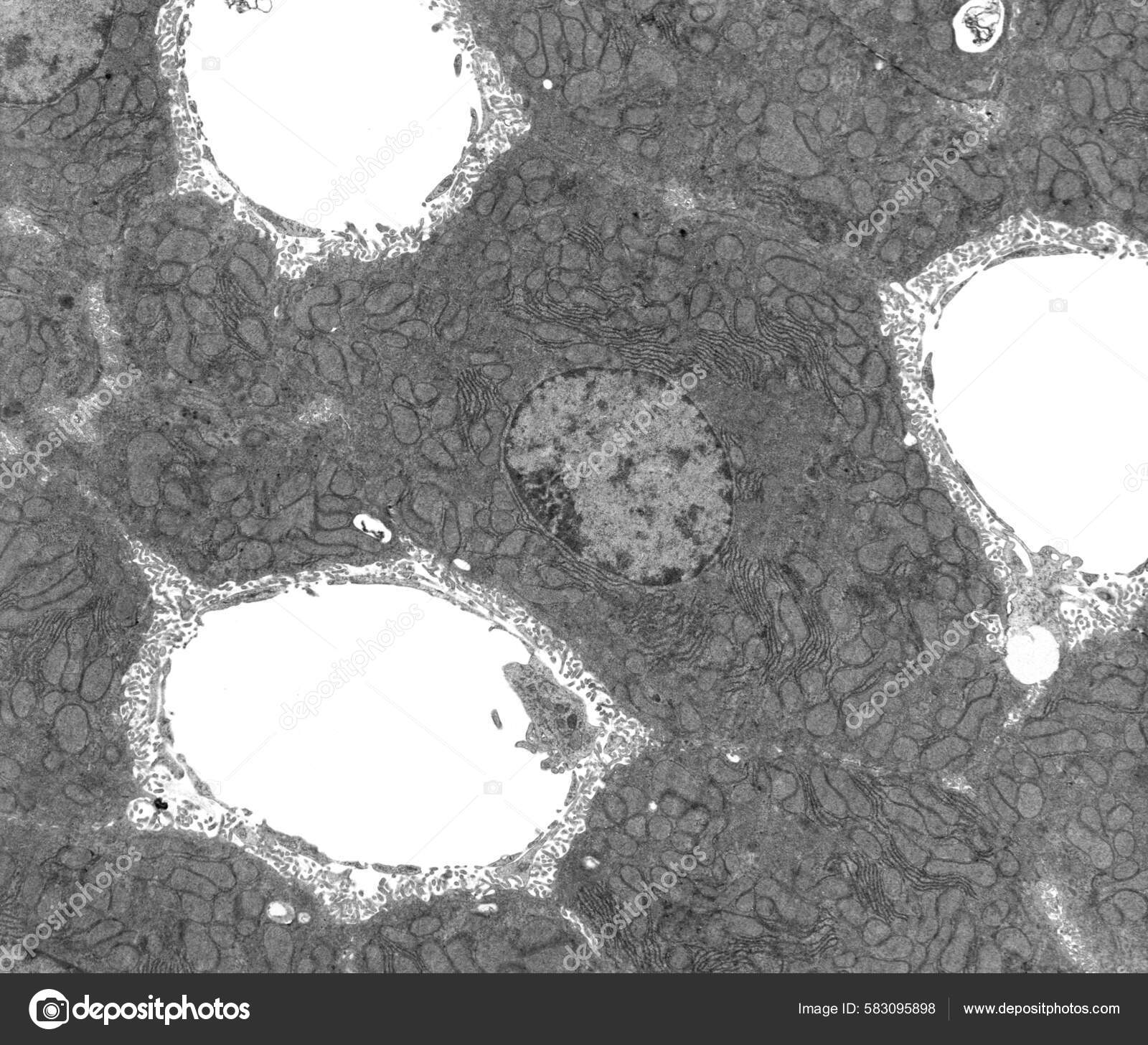 Liver Cell Electron Micrograph