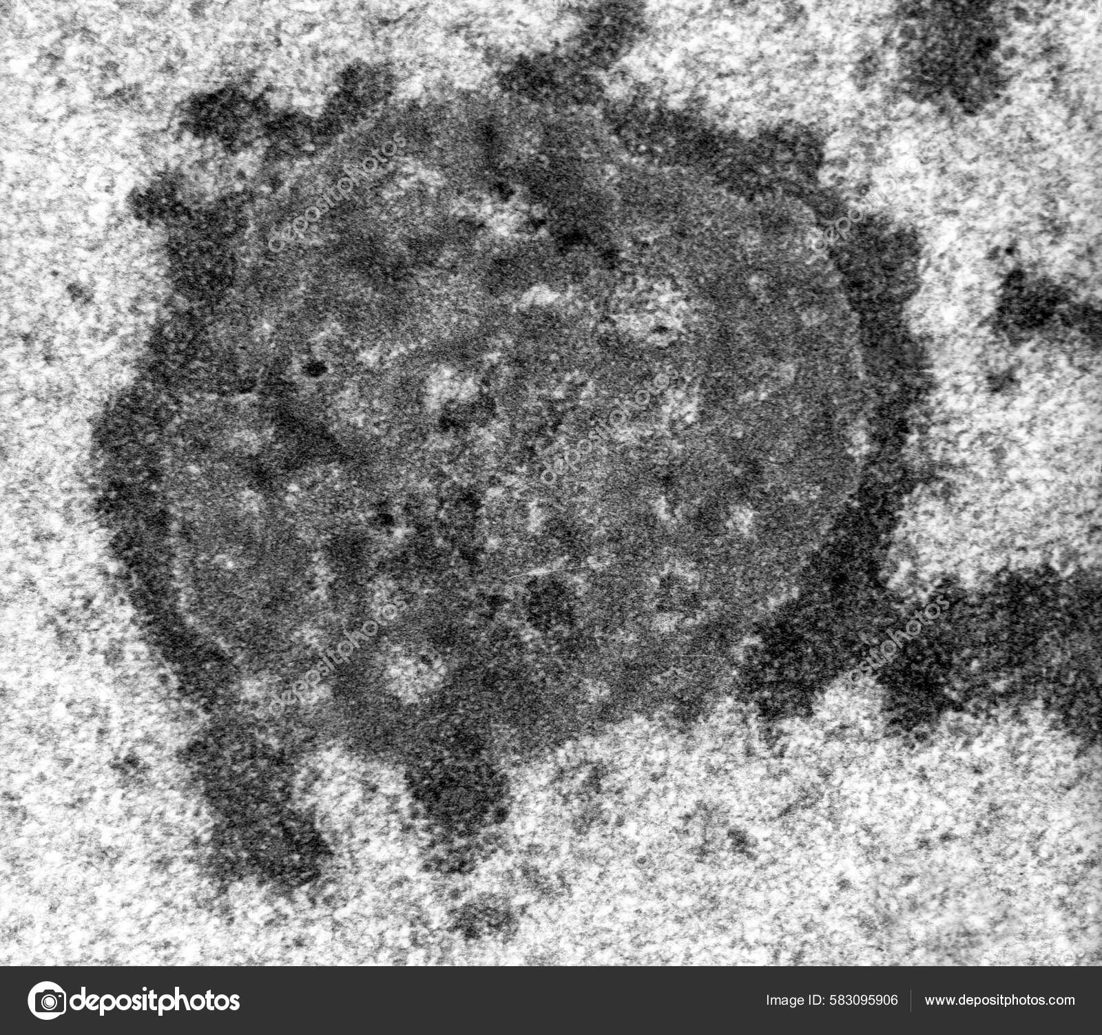 Nucleolus Micrograph