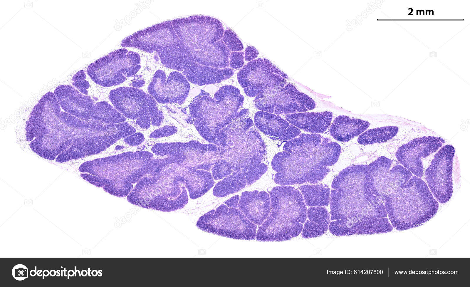 Microscopio Luz Baja Potencia Una Glándula Del Timo Humano Manchado ...