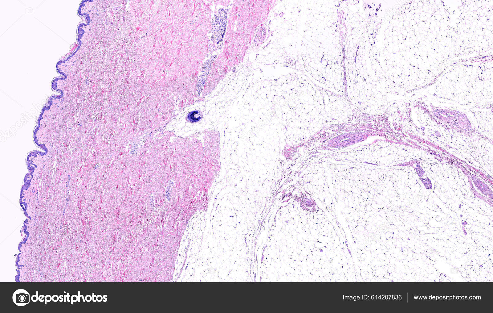 Low Power Light Microscope Micrograph Thin Skin Showing Form Left Stock ...