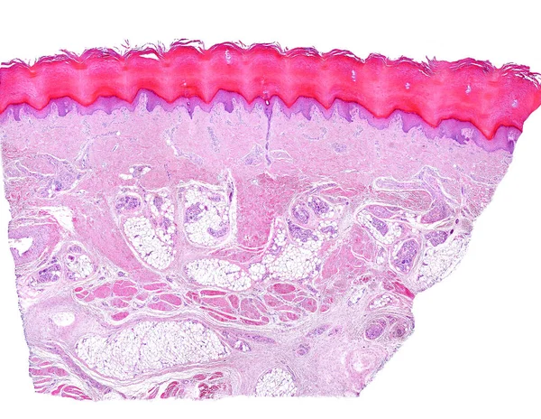 Human epiglottis — Stock Photo © jlcalvo@ucm.es #180037574