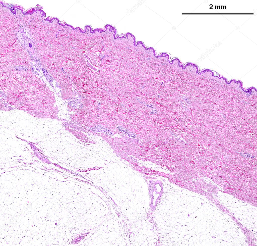 Microscopio ligero de baja potencia de piel delgada que muestra de ...