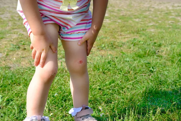 Knees bleeding Stock Images - Search Stock Images on Everypixel