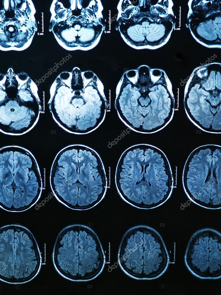 MRI Brain Scan Stock Photo by ©Bunyos30 18727863