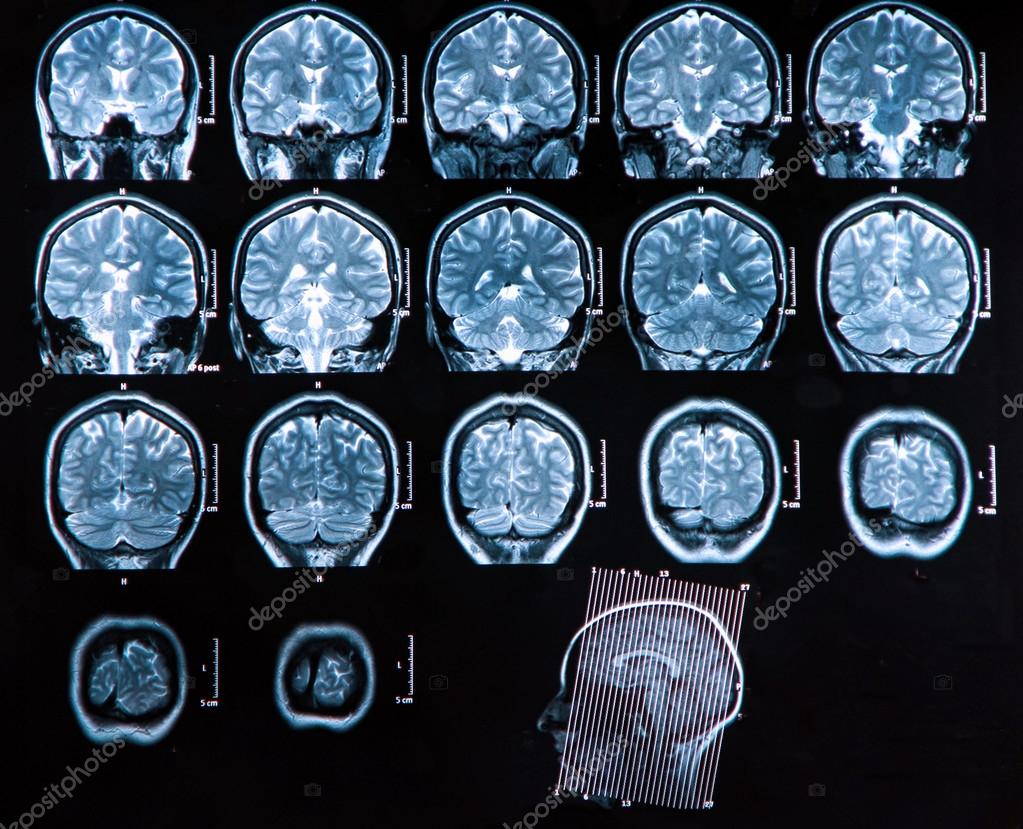 Mri Brain Scan Stock Photo by ©Bunyos30 23407338