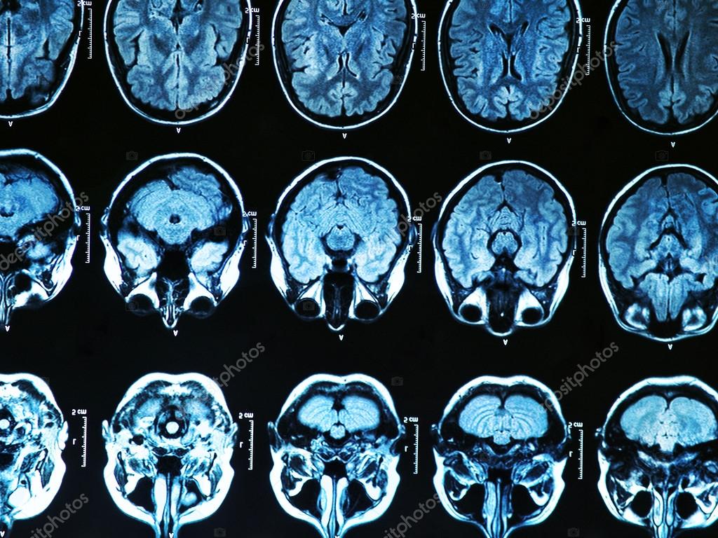 MRI Brain Scan Stock Photo by ©Bunyos30 27340907