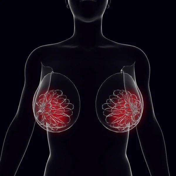 Breast cancer infographic Stock Photos, Royalty Free Breast cancer infographic Images ...