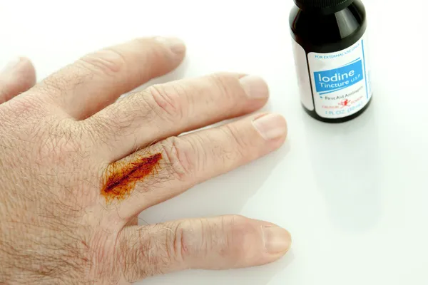 ᐈ Iodine stock images, Royalty Free iodine photos | download on ...